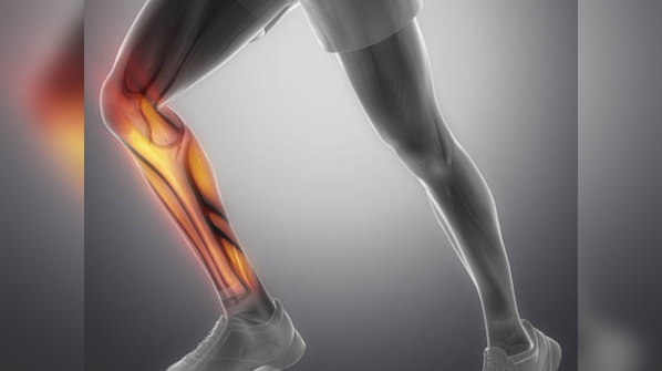 Exercises to strengthen the soleus muscle (one of the potential muscles ...