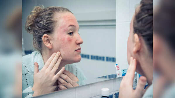 Stomach Cancer Symptoms: The sign on the face associated with early ...