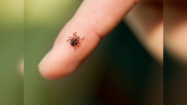 CCHF Fever Symptoms: CCHF fever, listed as a priority disease by WHO, kills 1; know all about it ...