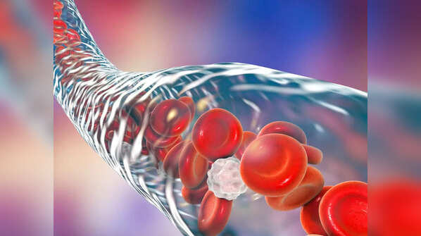 High blood pressure: Signs of poor circulation in your feet