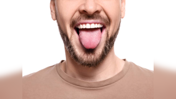 The color of your tongue can reveal THESE diseases