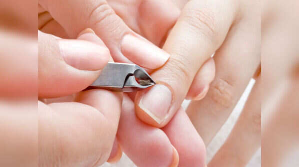 Why you should never rip off your hangnail