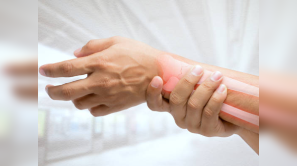 What is the difference between sprain, strain, ligament tear and fracture?