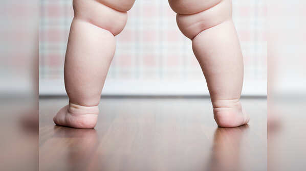 These 8 foods are the biggest cause of childhood obesity