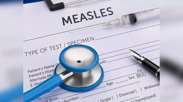 Measles in kids: Early symptoms to watch out for; preventive steps to take