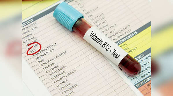 Vitamin B12 deficiency Symptoms: THIS sign in the feet may be hard to ...