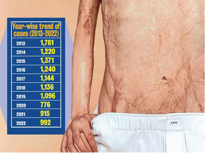 Burn cases on decline