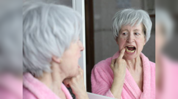 Oral cancer: Specific areas in your mouth where cancer can begin (along ...