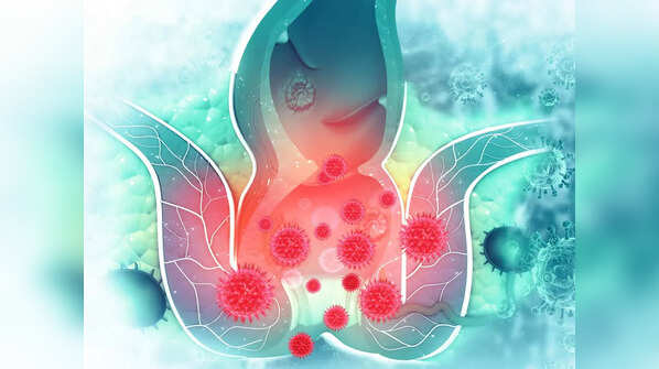 Piles Symptoms: 5 daily habits that can cause piles