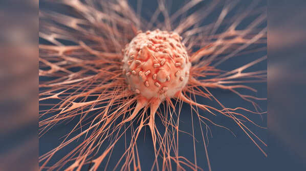 Cancer symptom: Three types of cancers that can cause back pain; know ...