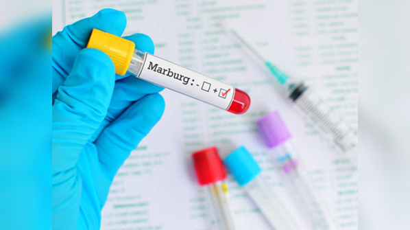 Marburg virus symptoms | As fatal Marburg virus claims two lives, 5 ...