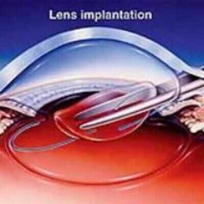 Contact lens implant surgery catching on with city youth