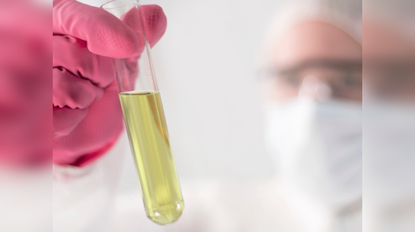 Here’s what your urine colour is telling you about your health