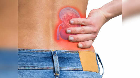 Common signs of kidney stones you should not overlook
