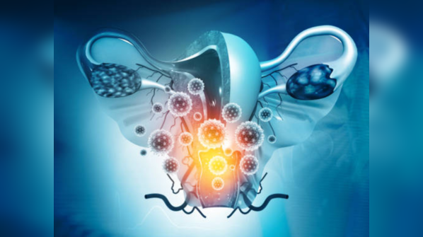 HPV and cervical cancer: Here’s how to lower the risk