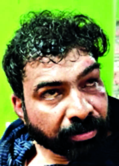 G Sandeep: Sandeep Sent To Police Custody | Thiruvananthapuram News - Times of India