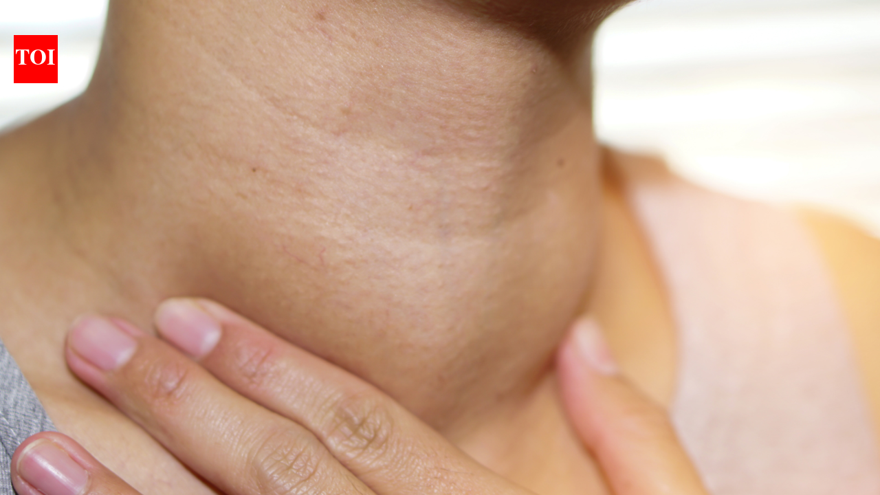 Hypothyroidism: How to lower your TSH through diet
