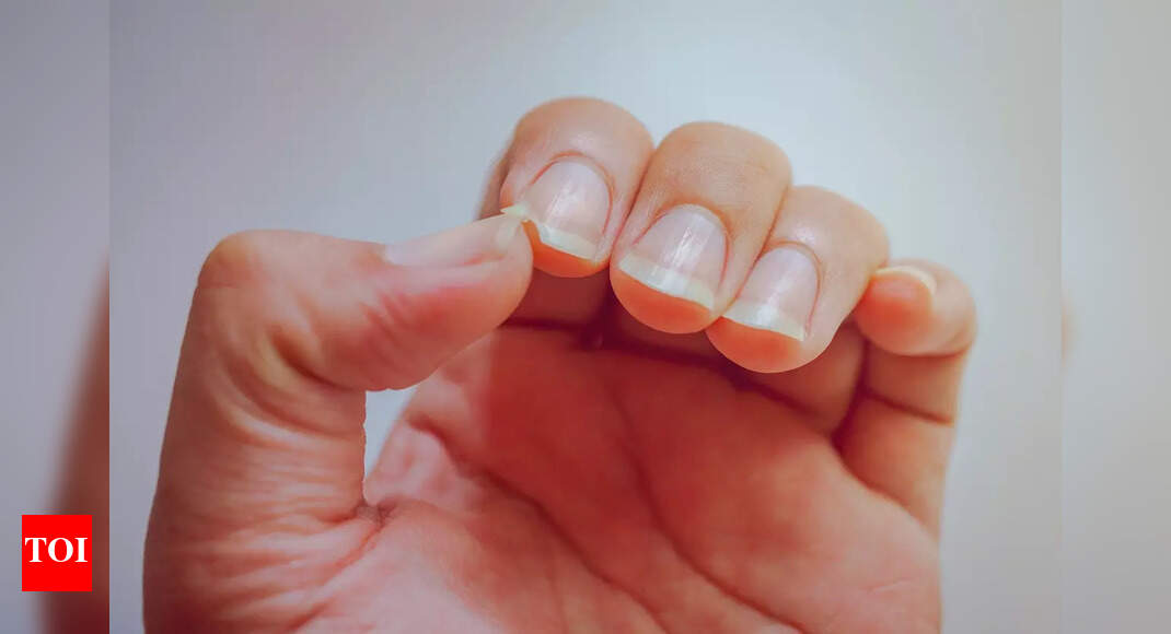 How to know if your nails need care - Times of India