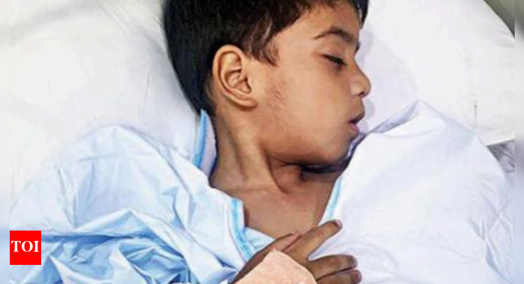 Delhi Stray Dog Attack: Pet dog enters a house, attacks 5-year-old boy ...
