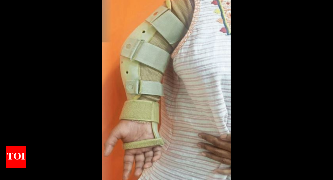 CA regains finger movement in reattached nearly-severed arm | Mumbai ...