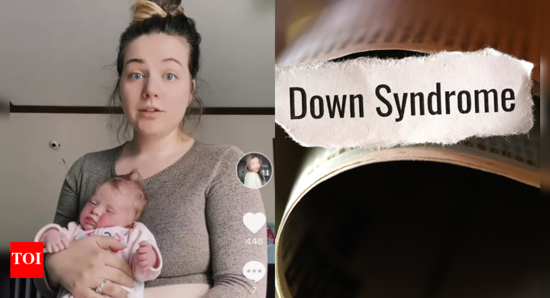 Viral: Mom discovers she herself has Down syndrome after having 3 kids with the condition ...