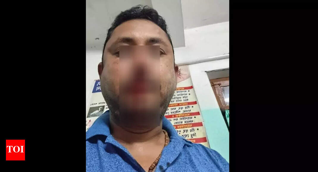 Tripura Mob vandalises hospital, attacks on-duty doctor | Agartala News ...