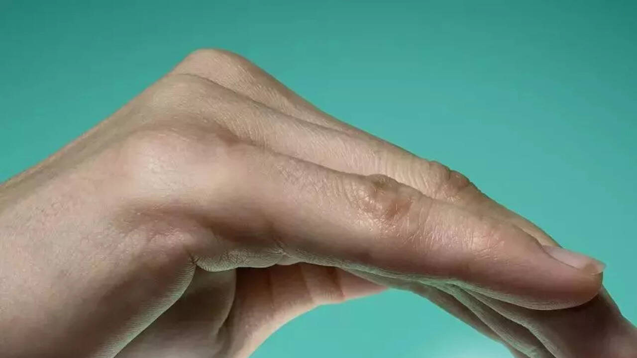 Nurturing Kidney Health: 3 Yoga Exercises For Optimal Renal Well-being