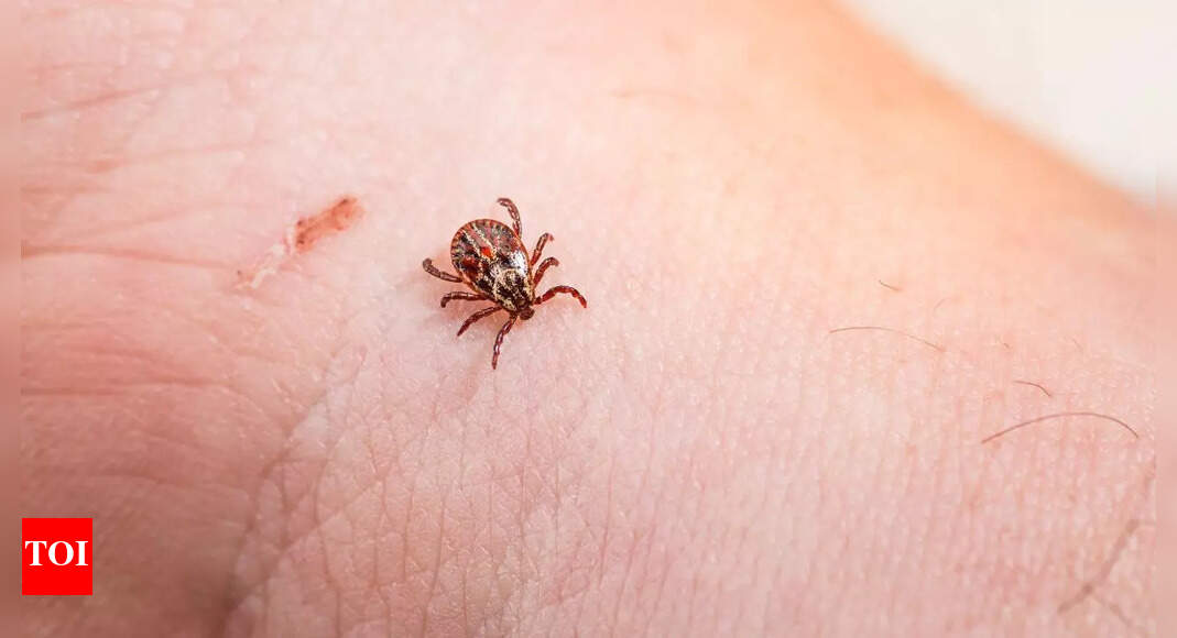 Ticks are now making Americans allergic to meat - Times of India