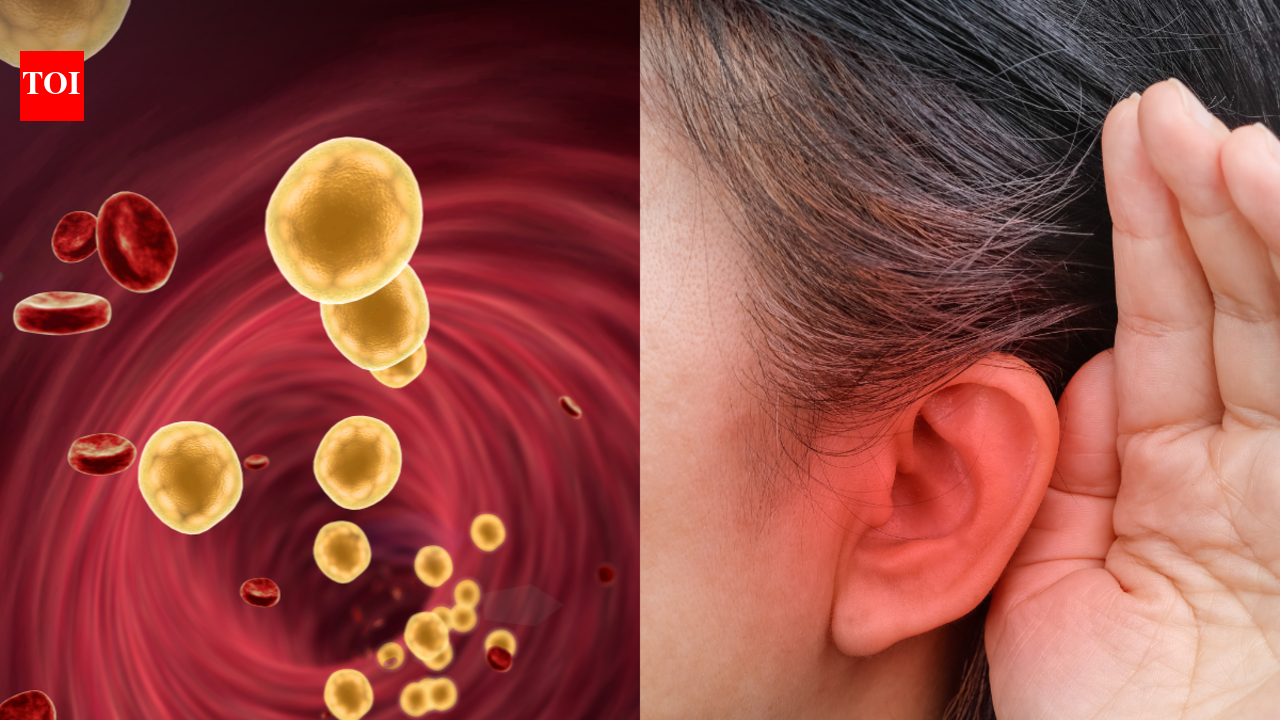 High cholesterol symptoms: THIS lesser-known sign could strike in your ears