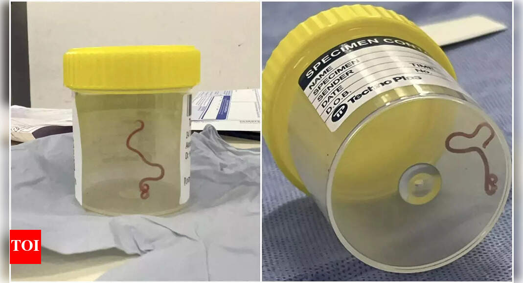 World’s first: Live 8-cm long worm found in brain of Australian woman ...