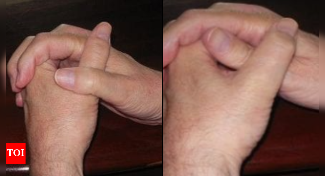 Personality test: How you cross your thumbs together when clasping ...