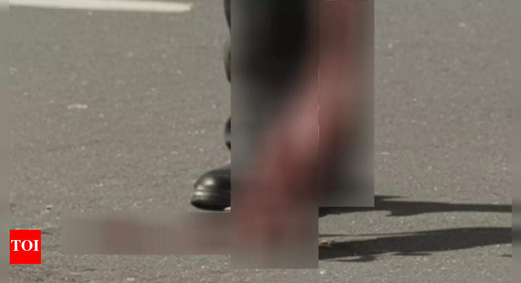 Bihar man loses arm, picks it up and walks on road | Patna News - Times ...