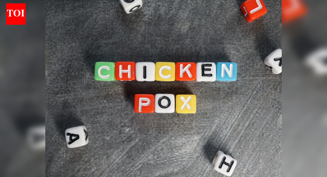 Chickenpox Symptoms: New variant of chickenpox-causing virus found in ...