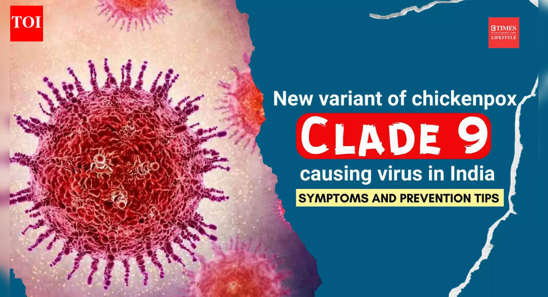 New variant of chickenpox in India; know the symptoms and prevention tips