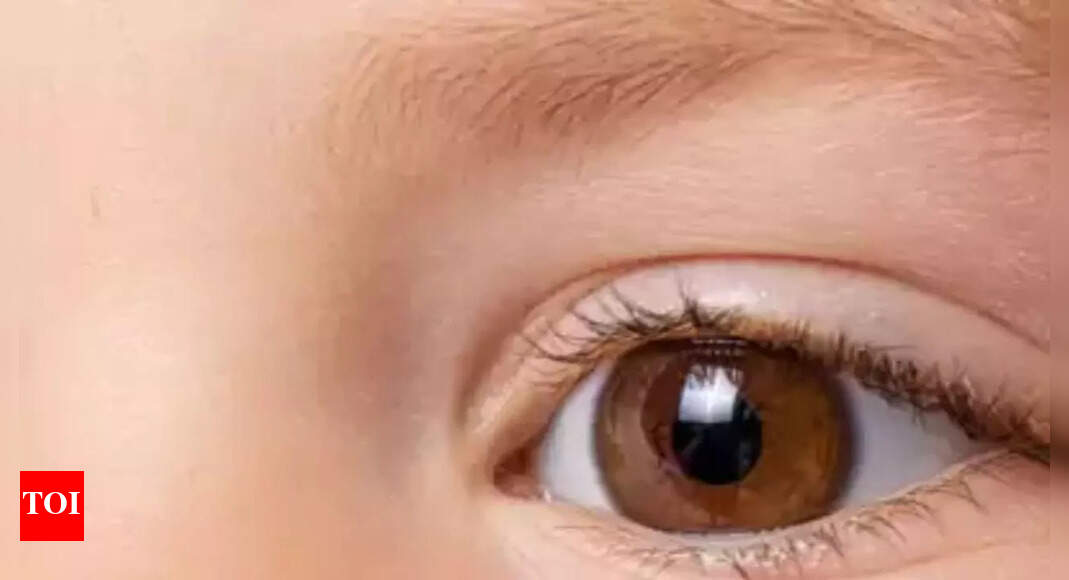 Intra-arterial chemo saves eyes and sight of 65% children with eye ...