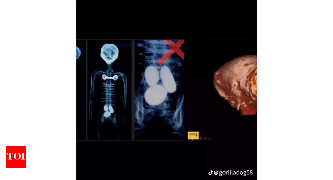 Mexico's alien bodies scanned, and here's what was found - Times of India