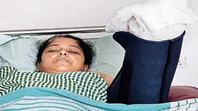 Bengaluru doctors reattach 4 of woman's fingers in 12-hour surgery ...