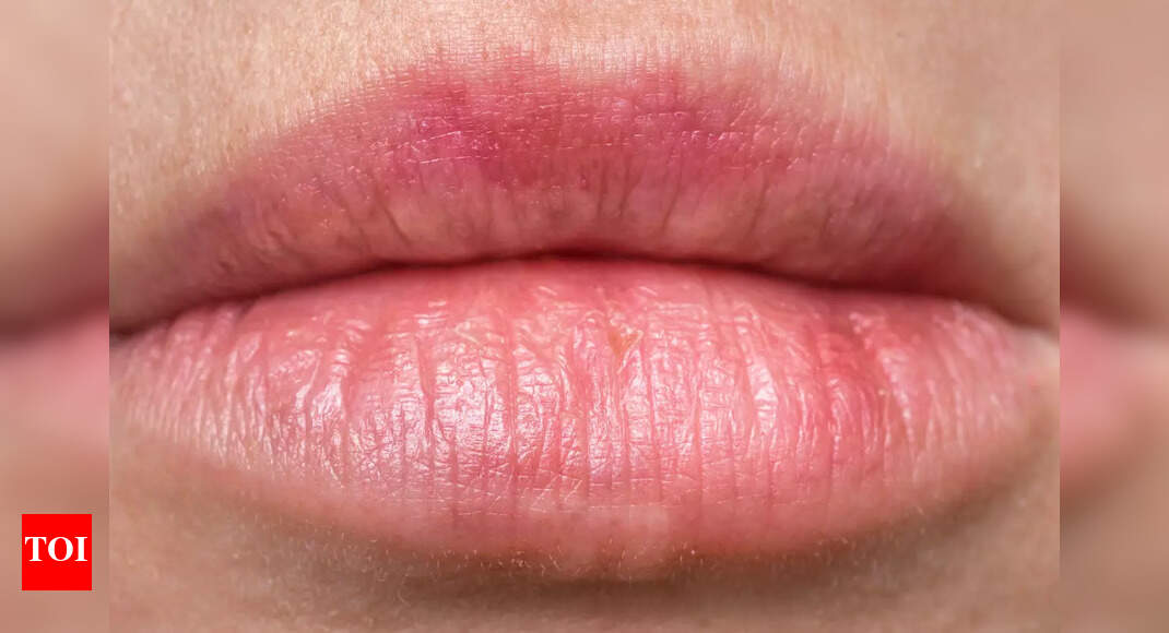 10 Home remedies to fix discolored lips | - The Times of India