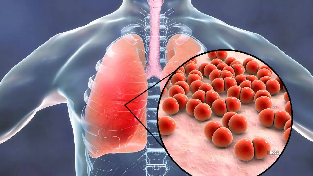 Yeast infection in lungs store