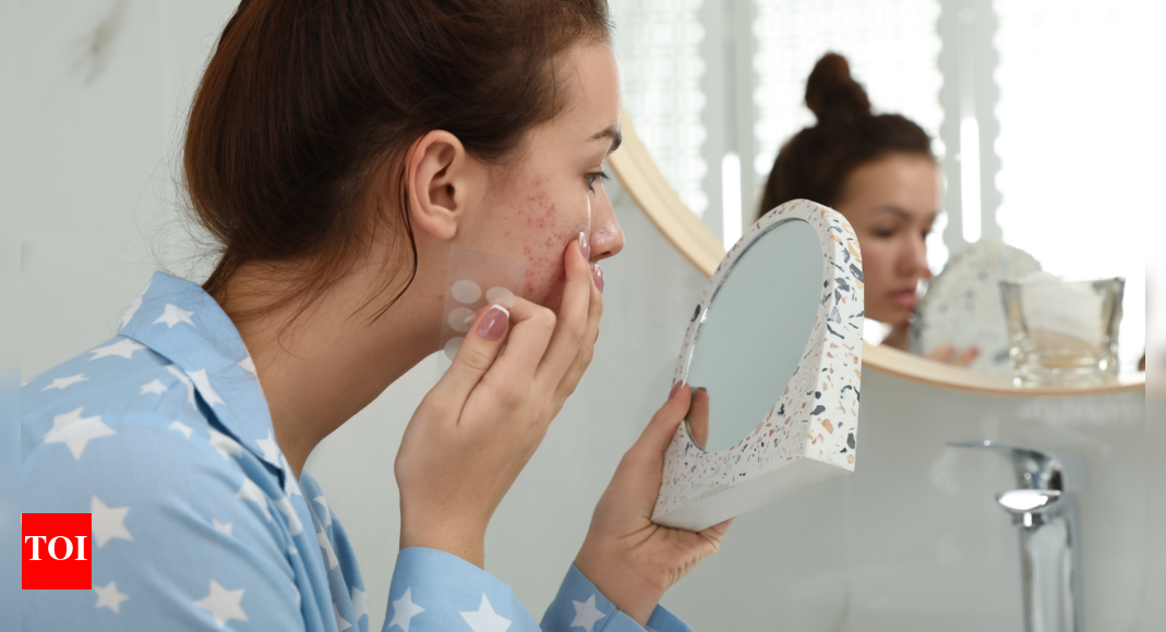 Pimple Patches: Your Go To Solution for a Clearer Face - The Times Reviews