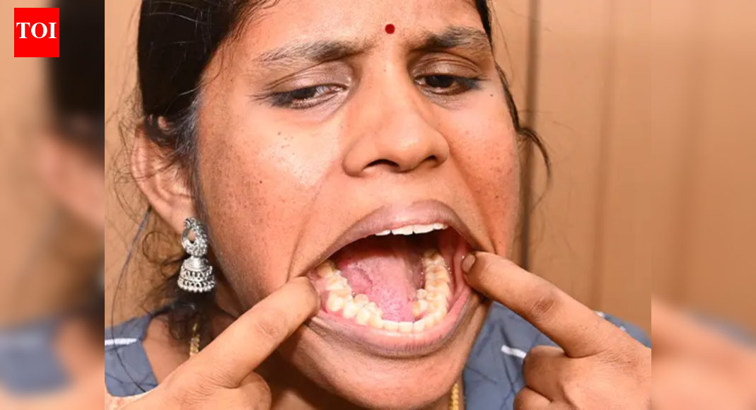 26 year old Indian sets world record for having the most number of teeth