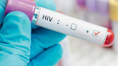 HIV Prevalence: ‘hiv Prevalence In State On The Decline’ | Ahmedabad ...