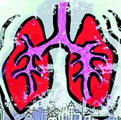 Ecmo, A New Lifeline For Lung Dialysis | Nagpur News - Times of India