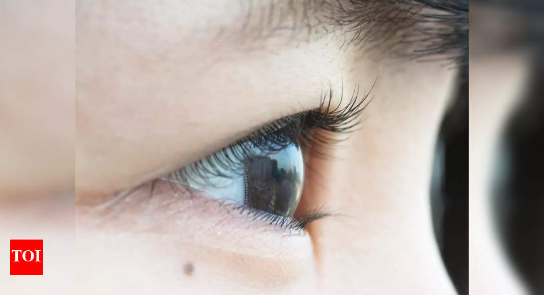 Decoding the Secrets of Moles According to Vedic Astrology - Times of India