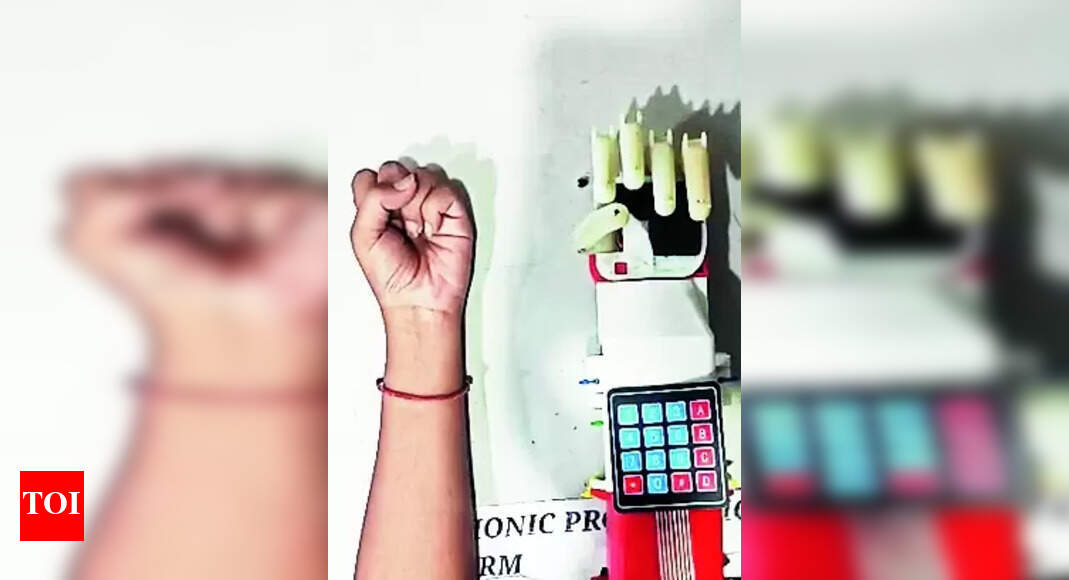 Active Prosthetic Arm: Prototype of Active Prosthetic Arm by Panjab ...