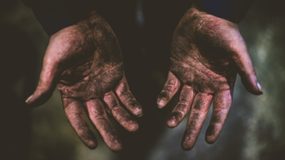 Kala Azar Symptoms: Understanding the role of Entomology in the fight ...