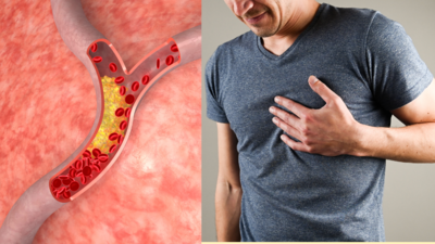 Sticky Cholesterol: 6 simple ways to bring it down | - Times of India