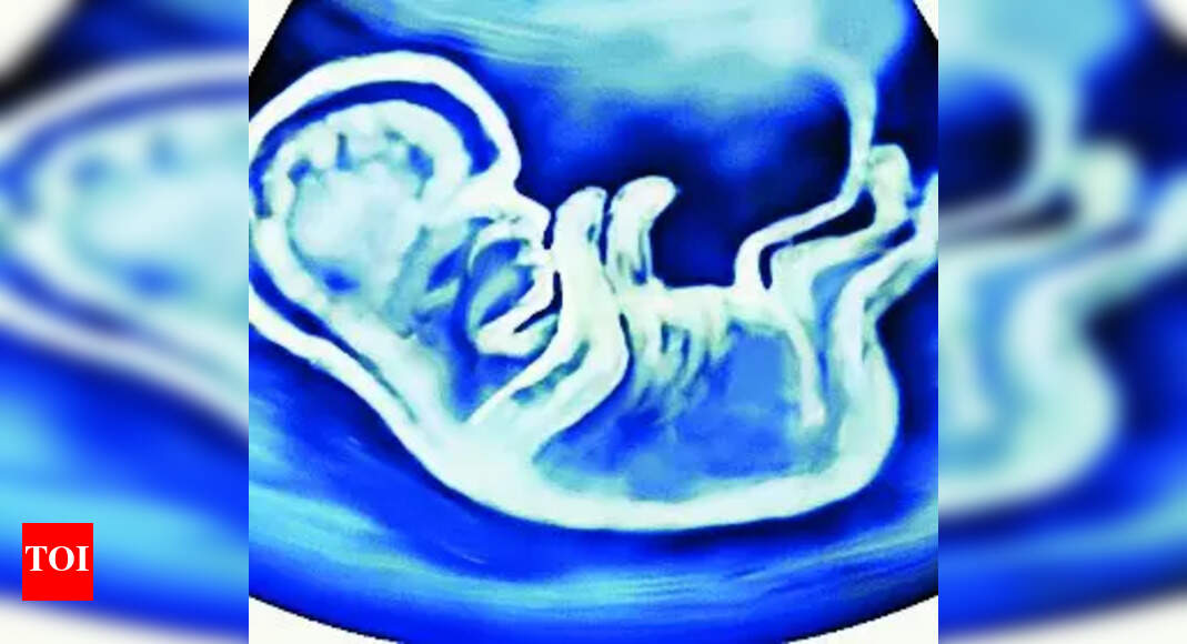 31-Week Anaemic Fetus: 31-week Anaemic Fetus Saved: Successful ...