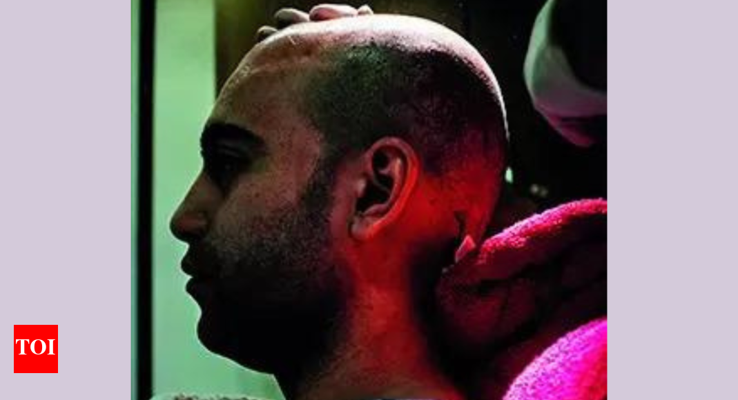 As China battles baldness, ED unearths Rs 11,793 crore hair racket ...