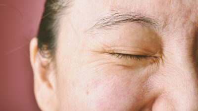 The connection between clogged eyes and glaucoma - Times of India